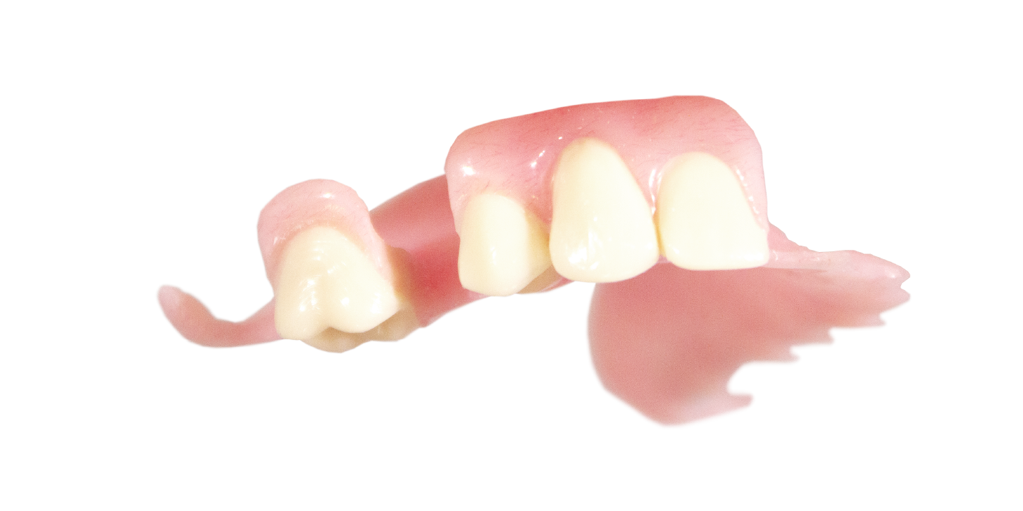 Gedeeltelijke gebitsprothese- TPP Novotny
